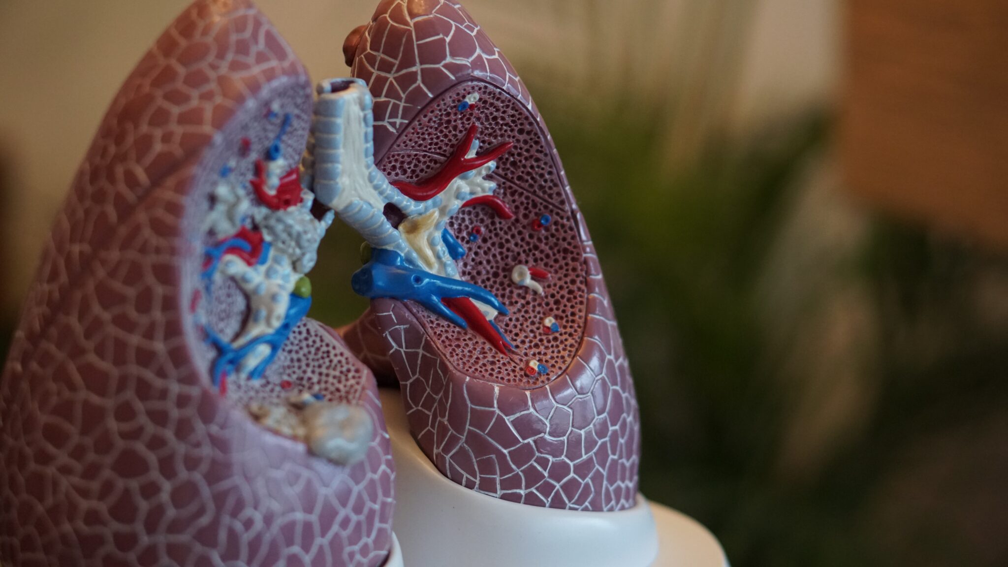 What Is Cystic Fibrosis The Secret Anatomy what-is-cystic-fibrosis-the-secret-anatomy